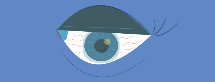 Macular Degeneration Symptoms Blurry Central Vision macular-degeneration-symptoms-blurry-central-vision