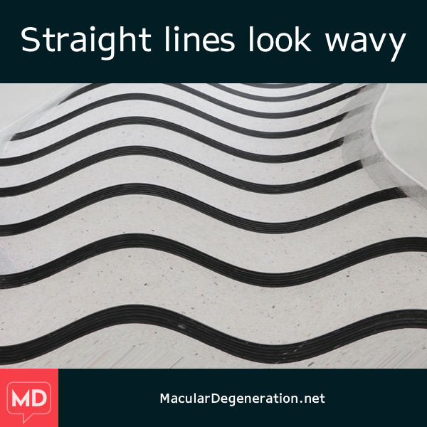 I See Wavy Lines In My Eyes Infoupdate